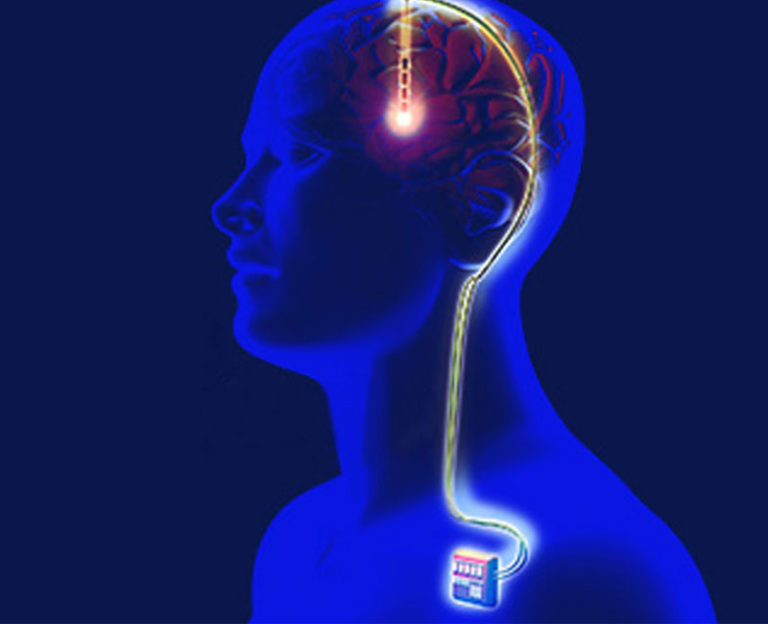 Fabio Godinho – Neurocirurgião Funcional
